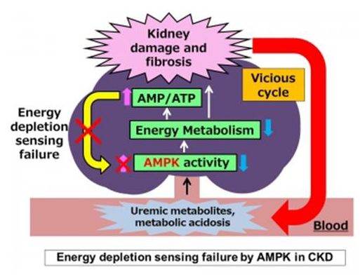 Cellular Energy Sensor Connected to Chronic Kidney Disease ...